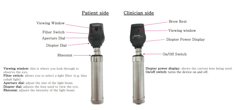 How to perform fundoscopy with a direct ophthalmoscope - Journal of the ...