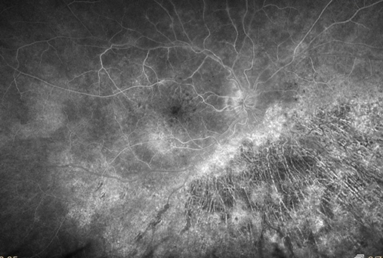 The Great Masquerader: A Clinical Case - Journal of the Foundations of ...