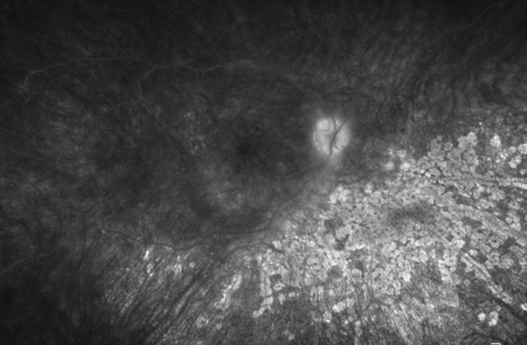 The Great Masquerader: A Clinical Case - Journal of the Foundations of ...