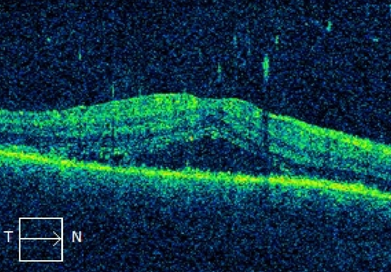The Great Masquerader: A Clinical Case - Journal of the Foundations of ...