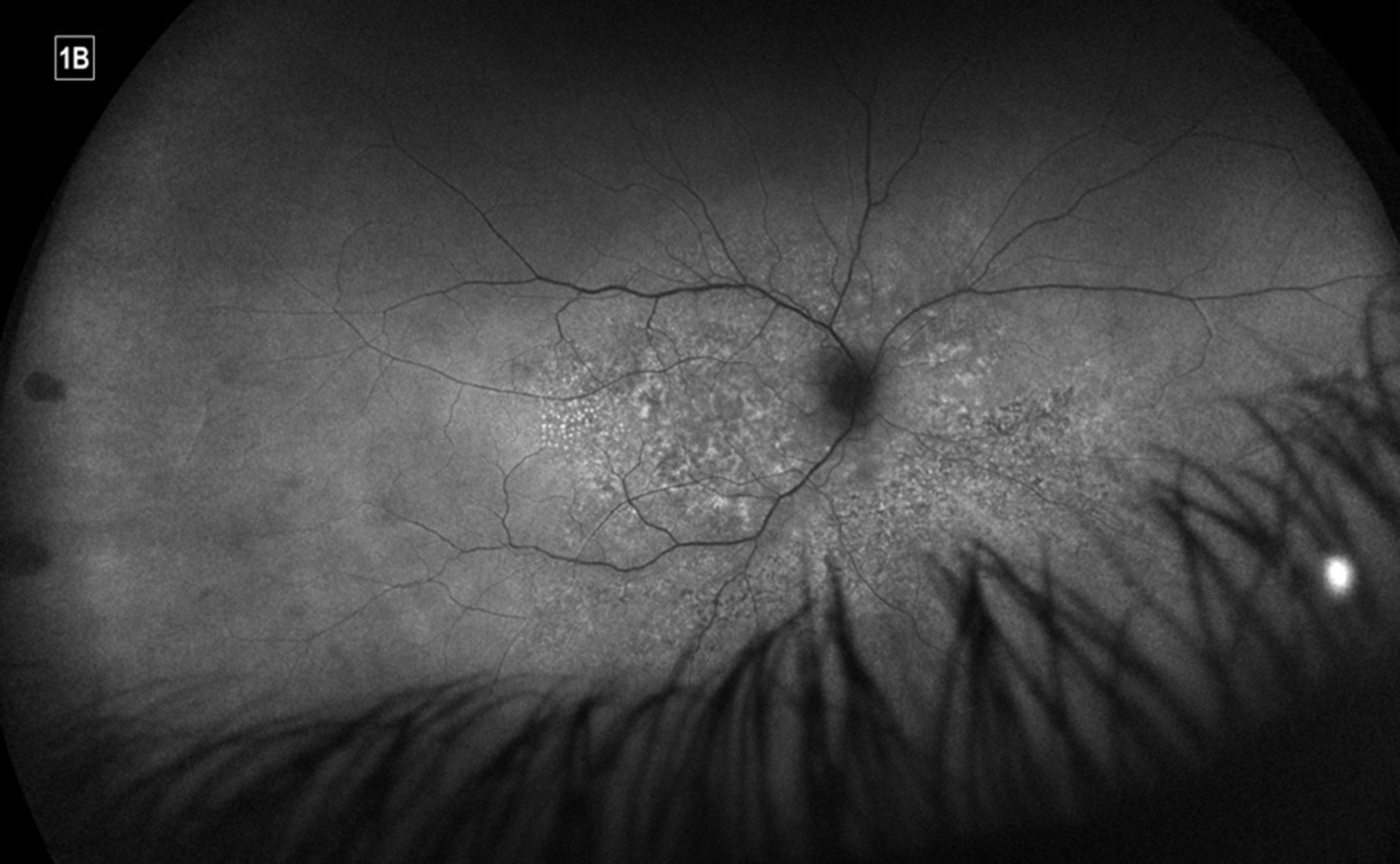 The Great Masquerader: A Clinical Case - Journal of the Foundations of ...