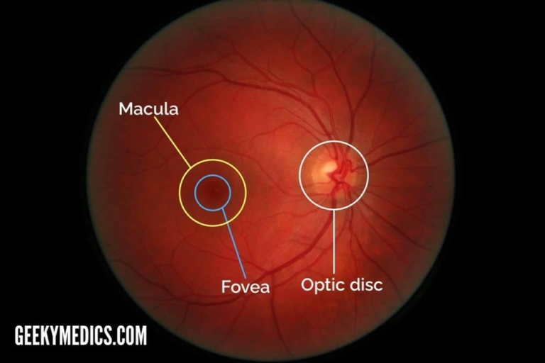 An Easy Approach for Direct Ophthalmoscopy In 8 Steps! - Journal of the ...